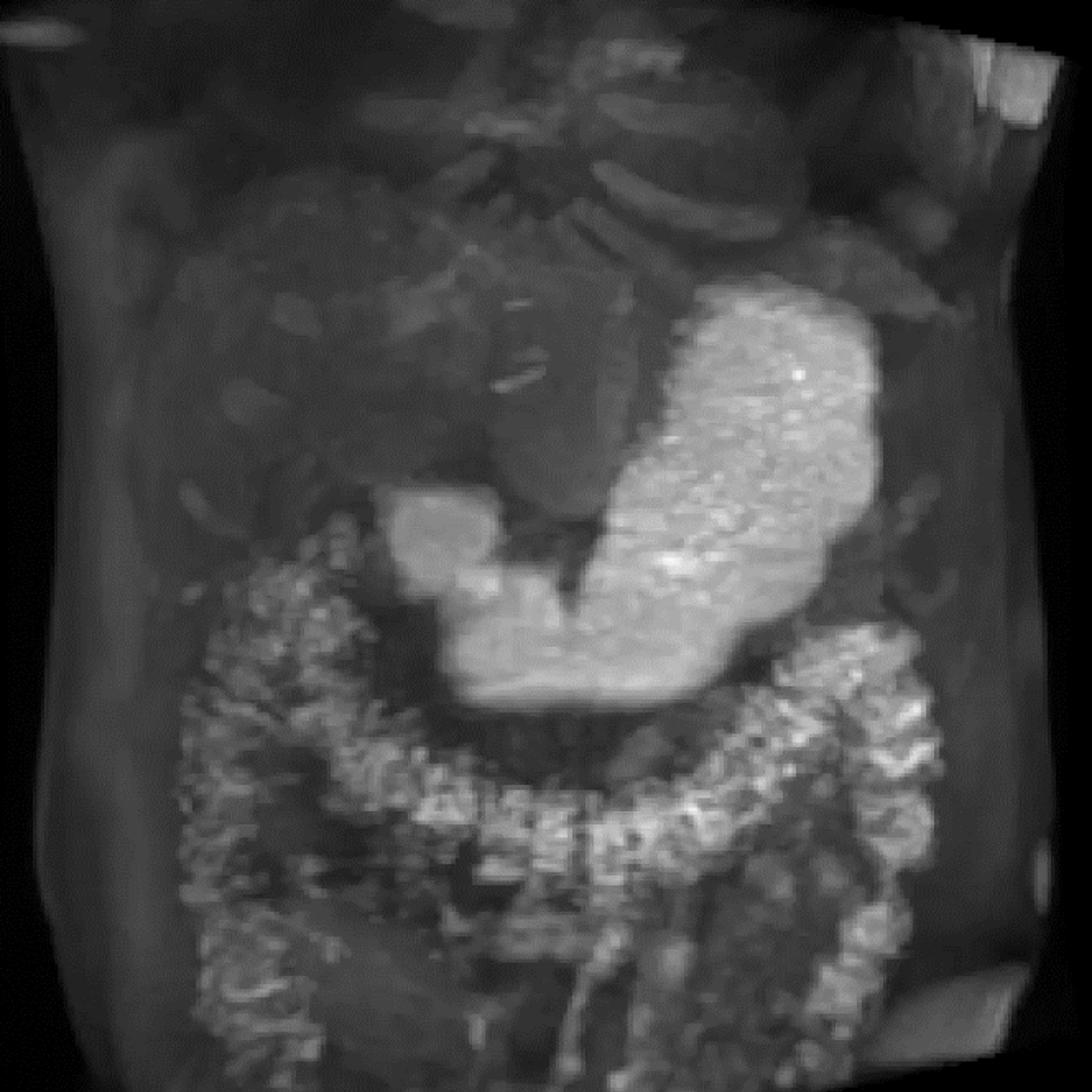 High-Definition Magnetic Resonance Imaging of the Human ...